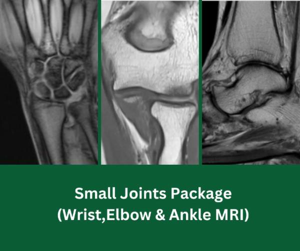 Msk Package