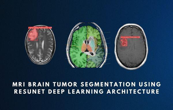 Yolov8 for custom dataset ASL Sign Language